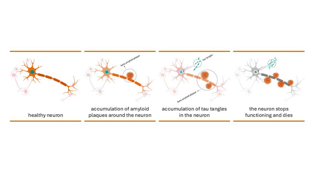 The history of Alzheimer´s Disease