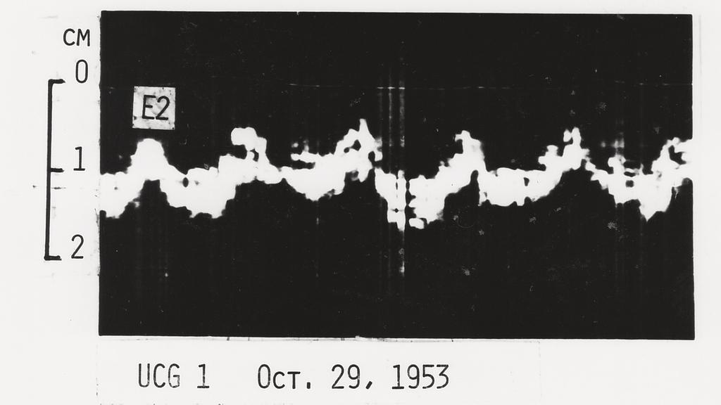 The birth of echocardiography