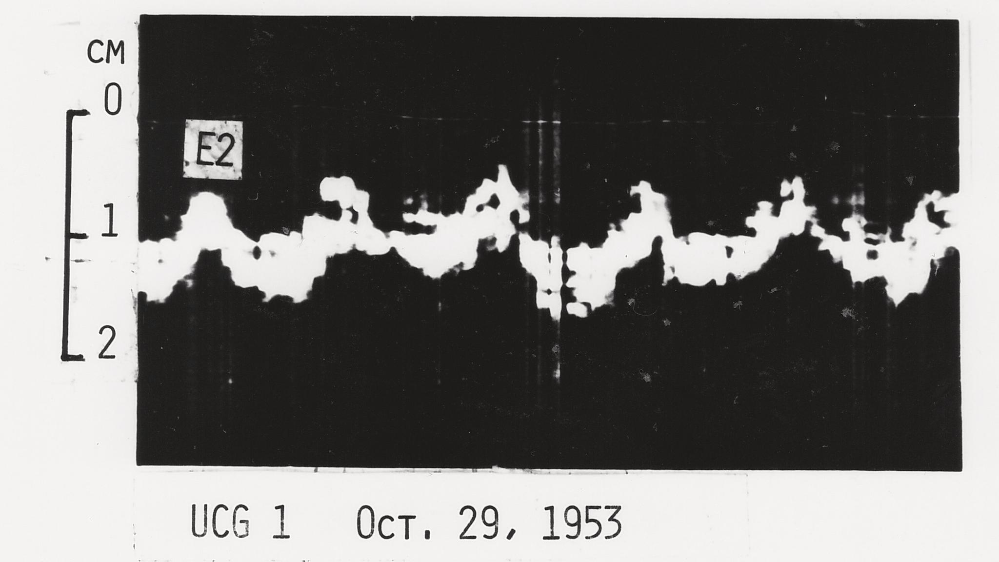 The birth of echocardiography