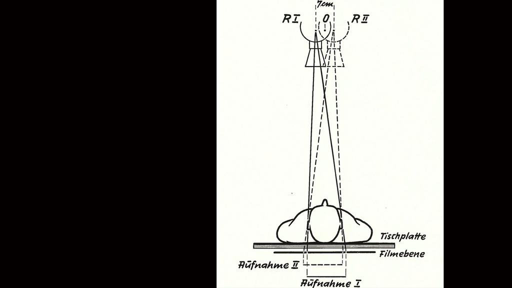 The 3 dimension in X-ray imaging